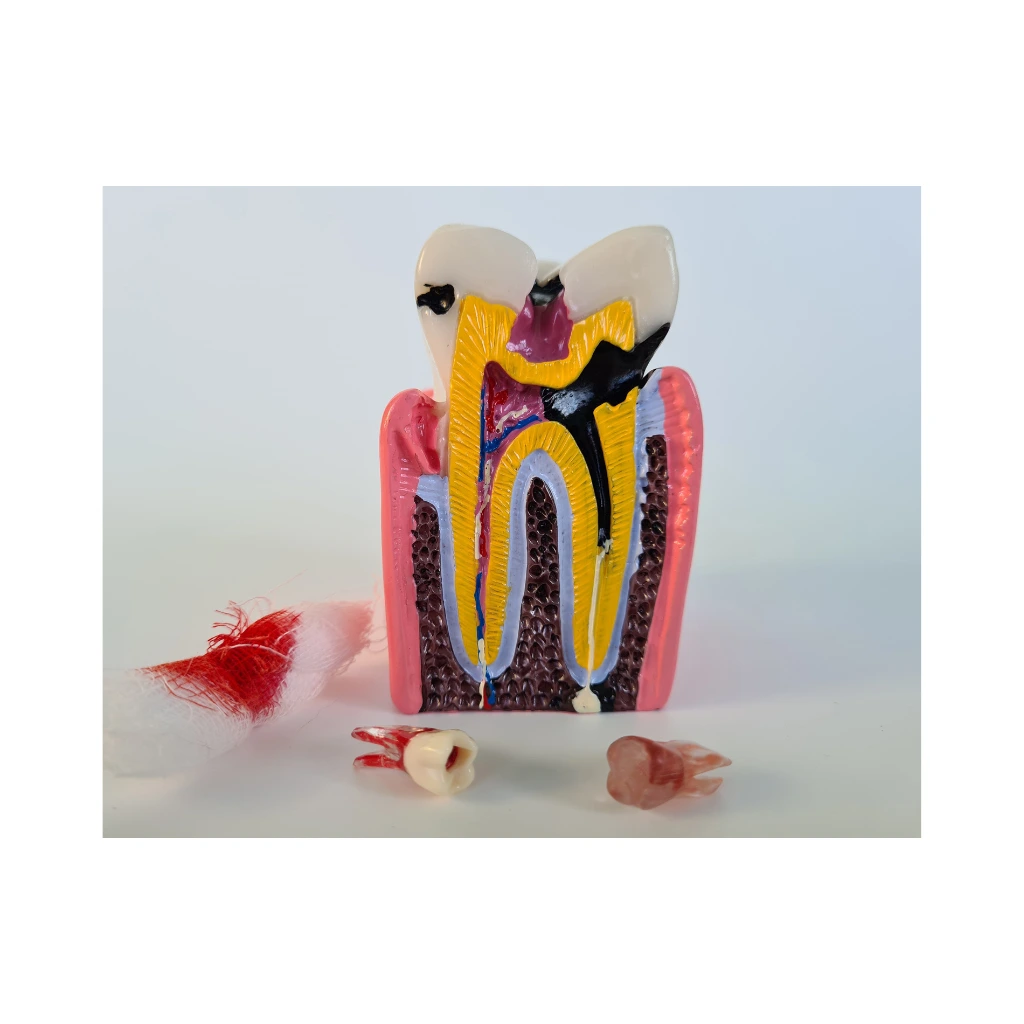 Who does root canal and crowns